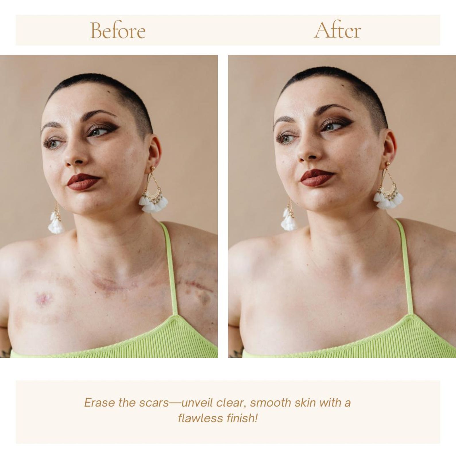 Scar Removal Photo Editing Service | Professional Skin Retouching - Etsy