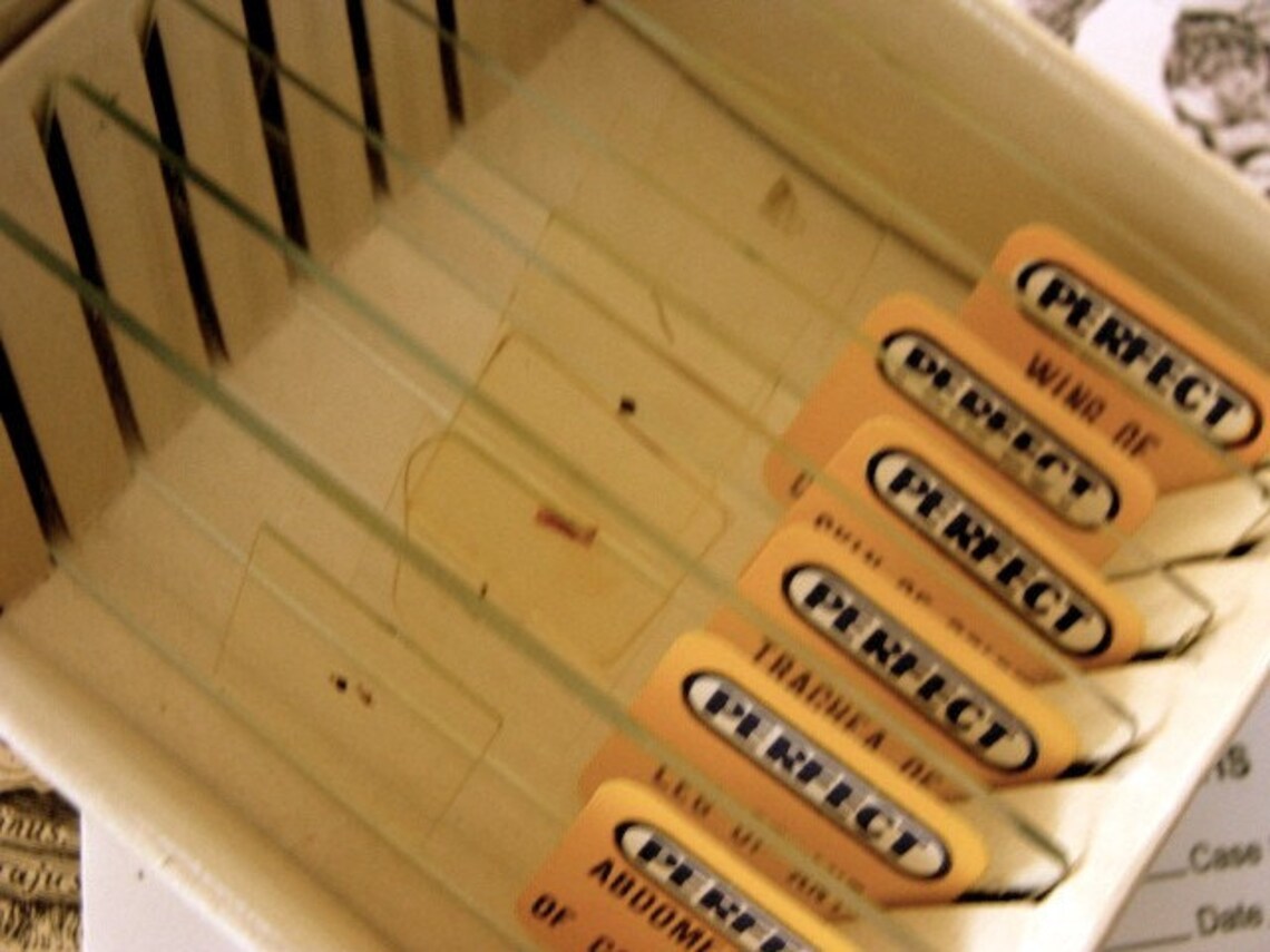 Dexter Blood Slides Vintage Specimen Slides Lot - Etsy