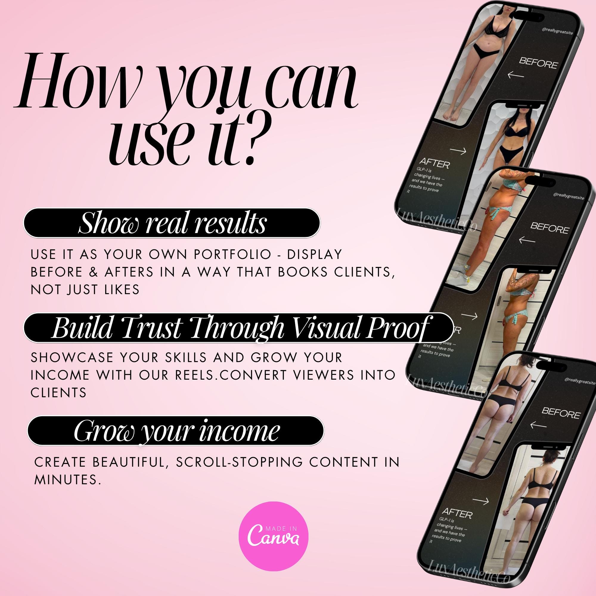 GLP-1 Weight Loss Instagram Canva Template | 32 Before & After Posts ...