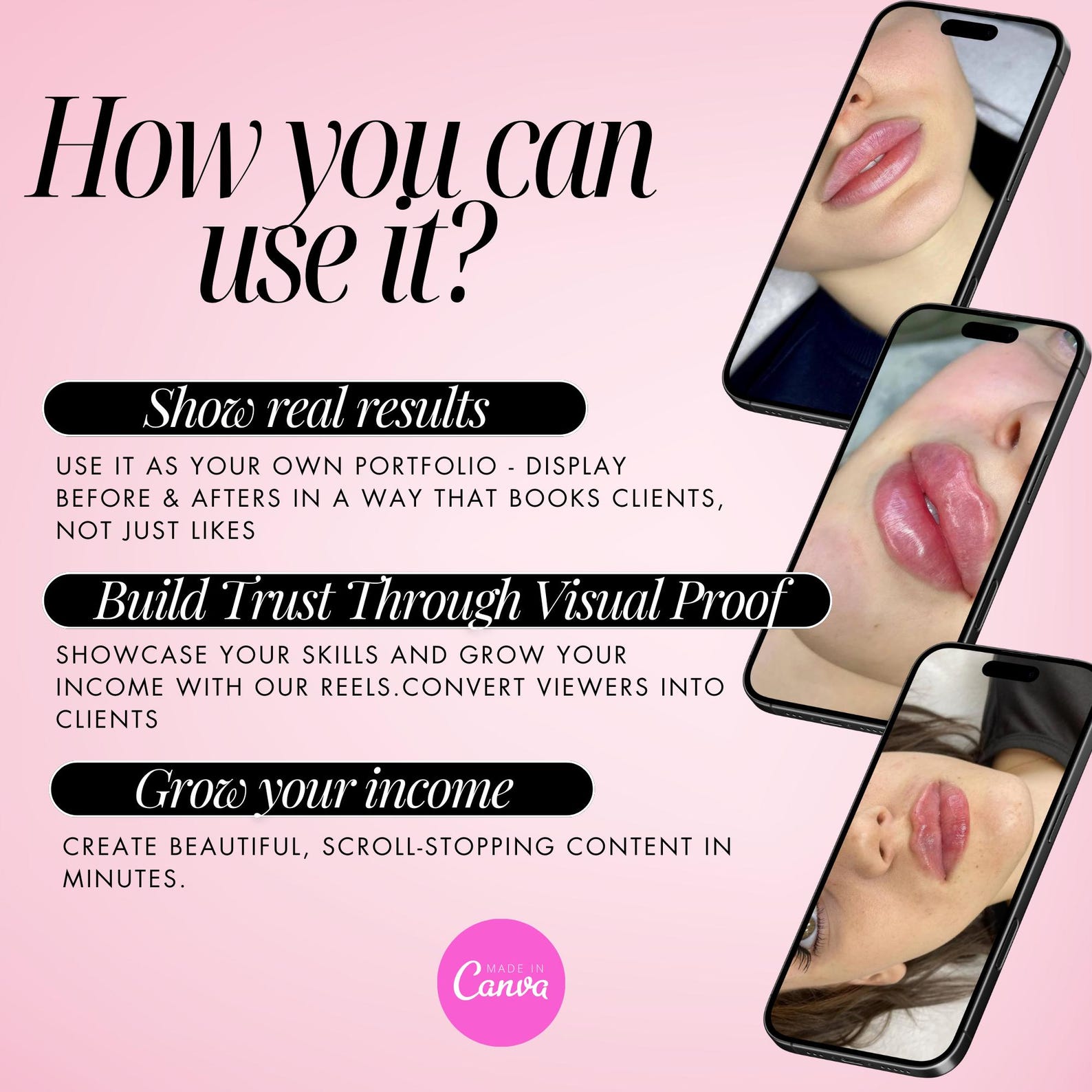 100 Lip Filler Instagram Post | Lip Injection Photo | Skincare Post ...