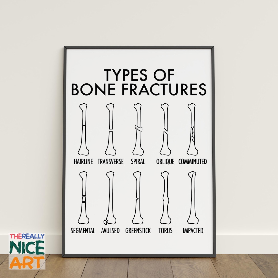 Bone Fractures PRINTABLE Wall Art, Detailed Medical Illustration ...