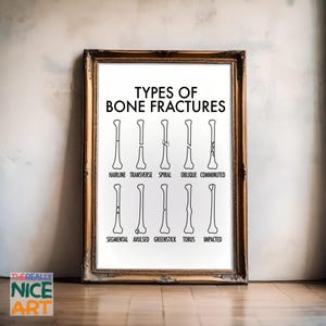 Bone Fractures PRINTABLE Wall Art, Detailed Medical Illustration ...