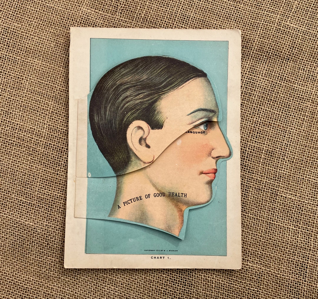 Vintage Medical Anatomical Flip Chart Lithograph Picture of - Etsy