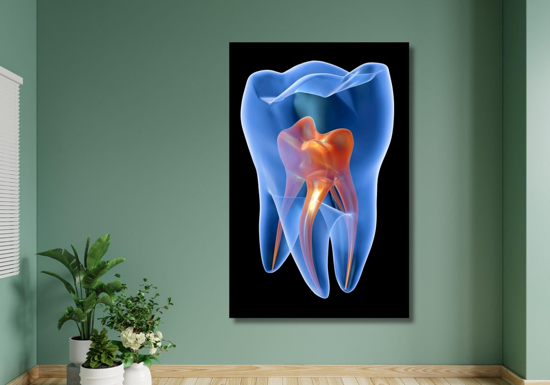 X-ray Molar Tooth Canvas,dentist Office Canvas Wall Art,teeth Wall Art ...
