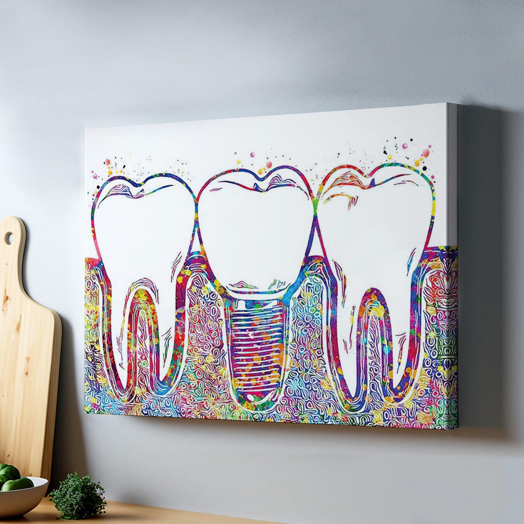 Colorful Dental Implants Dentist Art, Canvas Room Decor, Housewarming ...