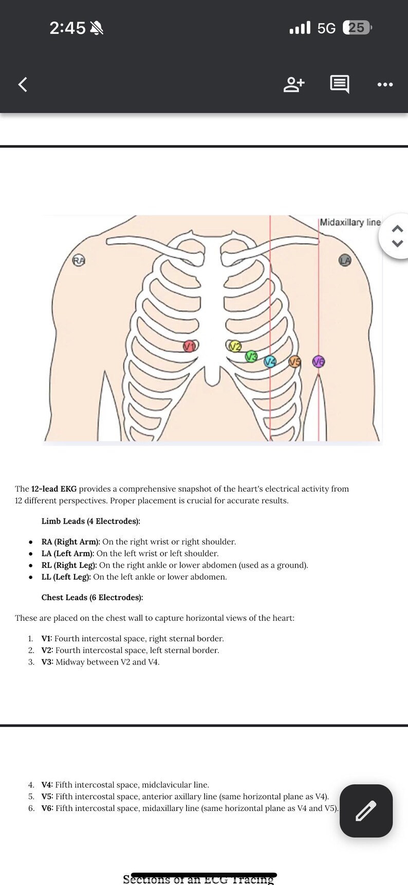 Cardiac Assessment and the Electrocardiogram ECG Rhythms Study Guide ...