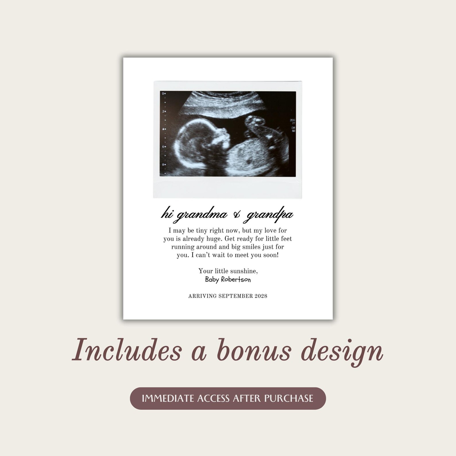 Pregnancy Reveal Photo Frame Gift for Grandparents: Editable Canva ...
