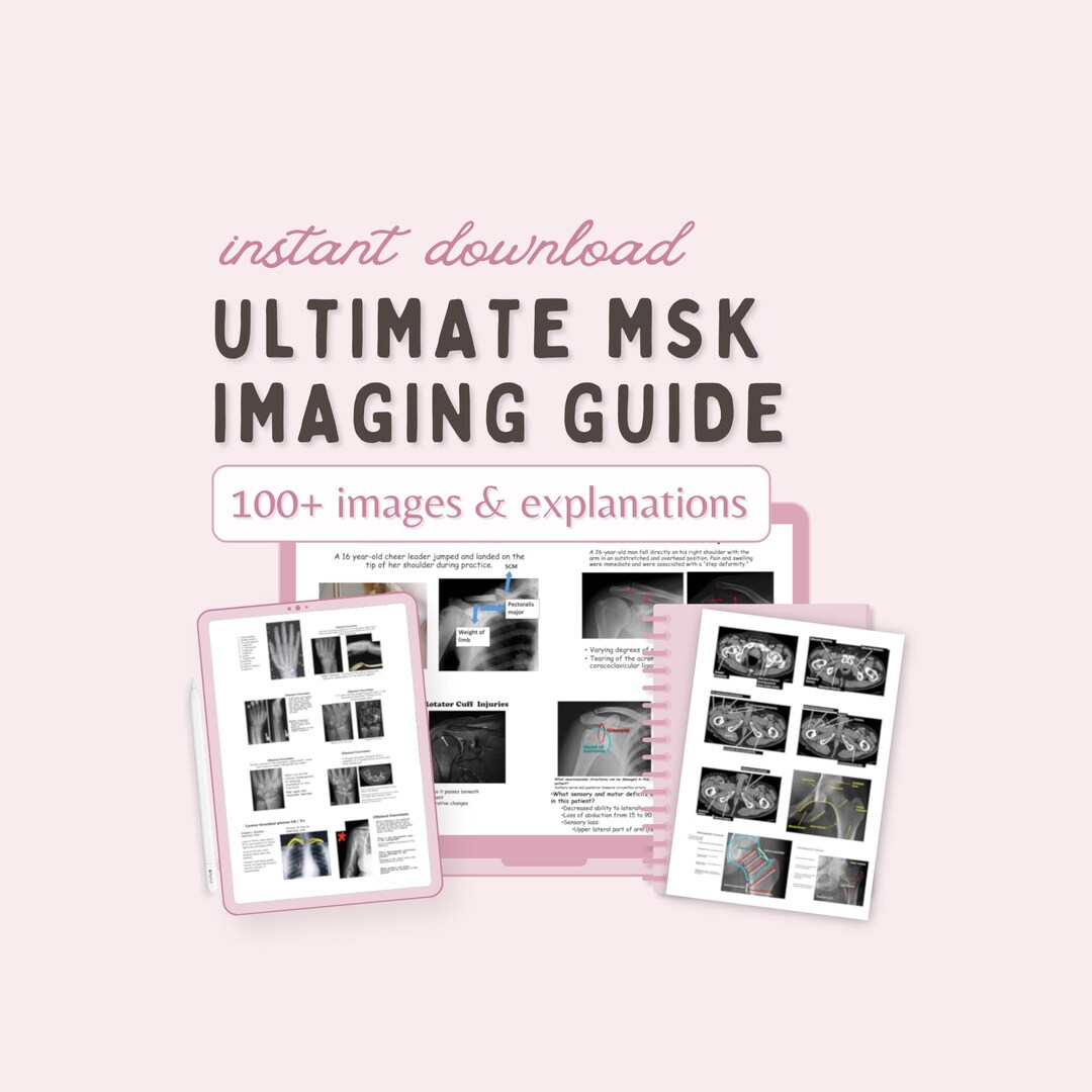 Musculoskeletal Imaging Guide High-yield MSK Study Notes Digital ...