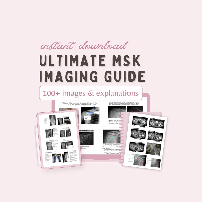 Musculoskeletal Imaging Guide High-yield MSK Study Notes Digital ...