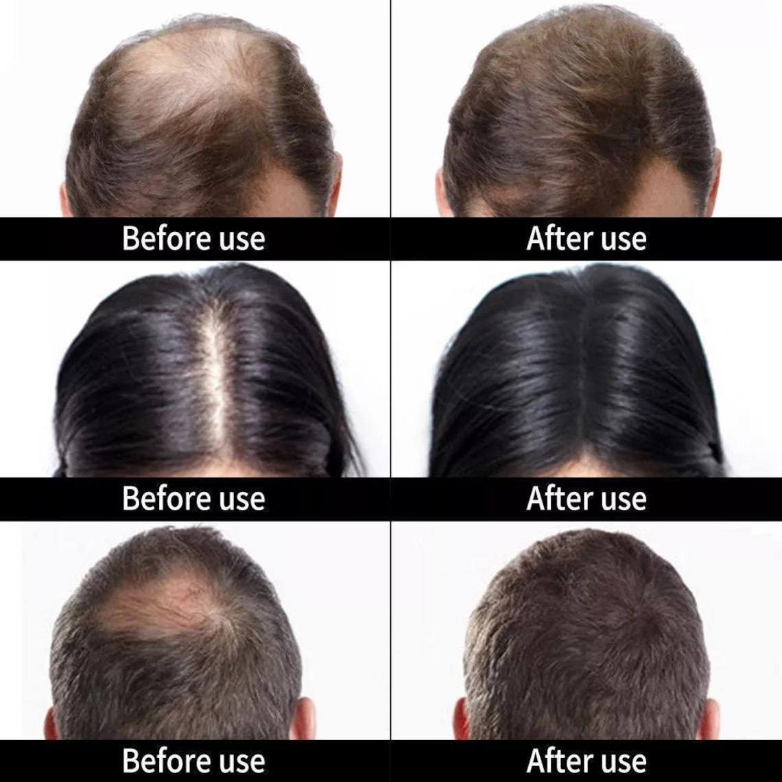 Toppik Hair Building Fibers LARGE 27.5g - Etsy