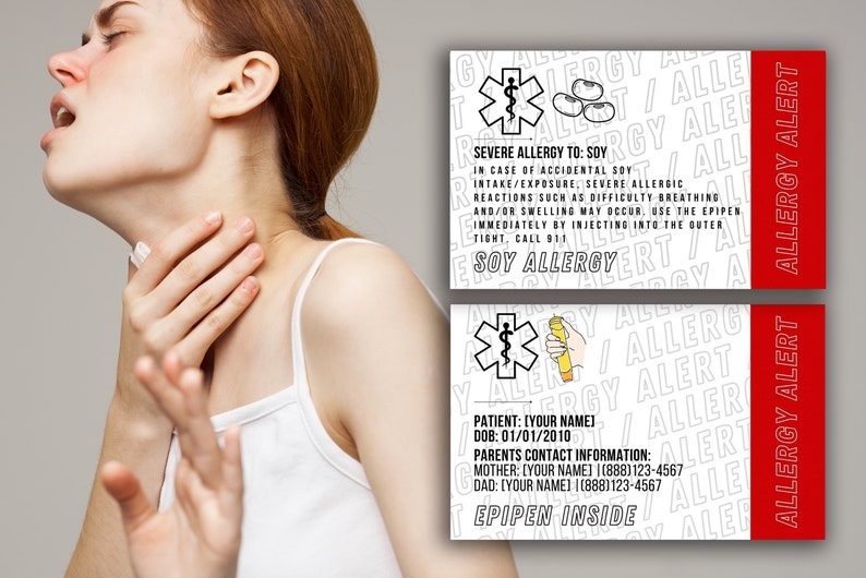 Personalized Allergy Alert Card for Kids - 10+ Food Allergies to Select ...
