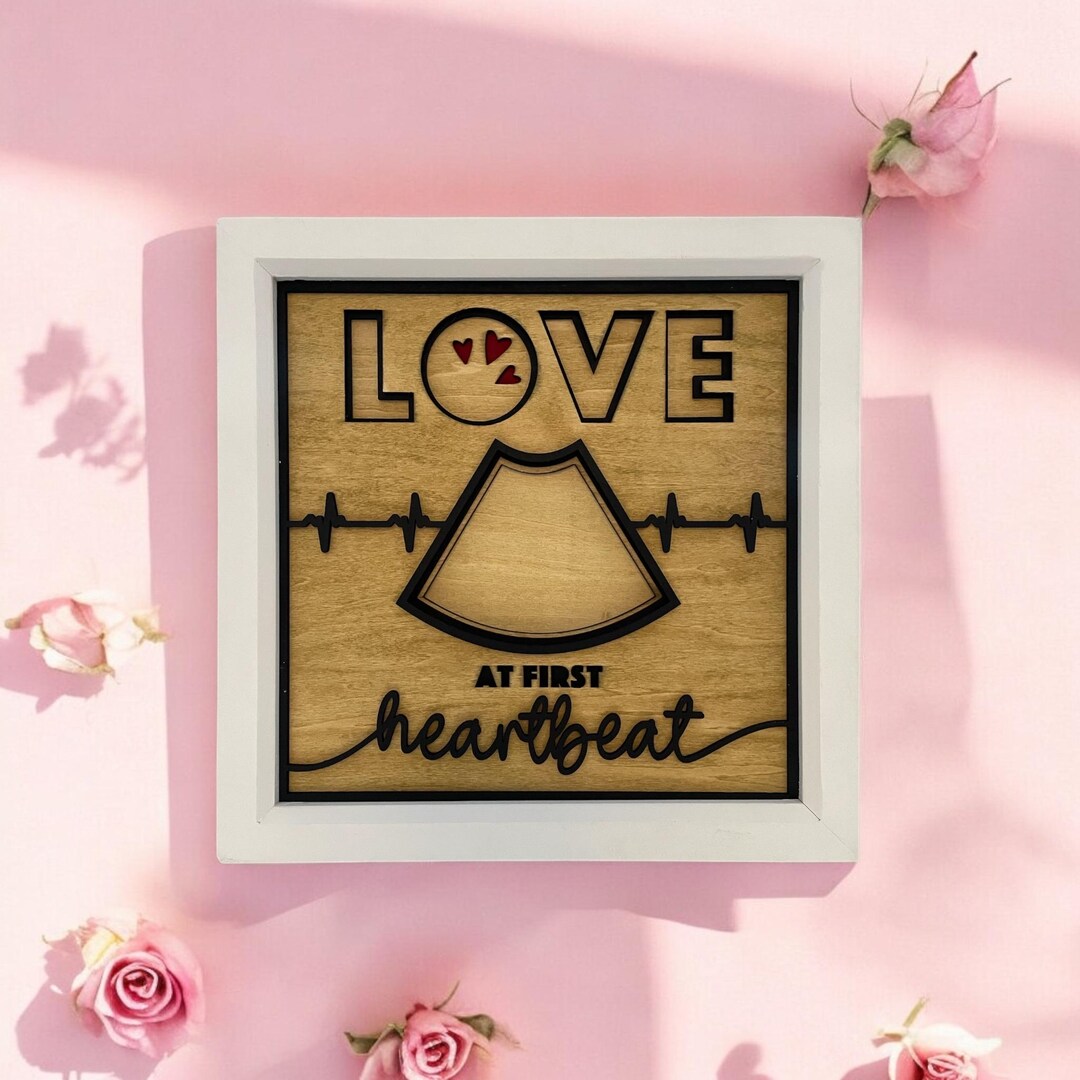 Love at First Heartbeat. Ultrasound Picture Display Frame Wallart - Etsy