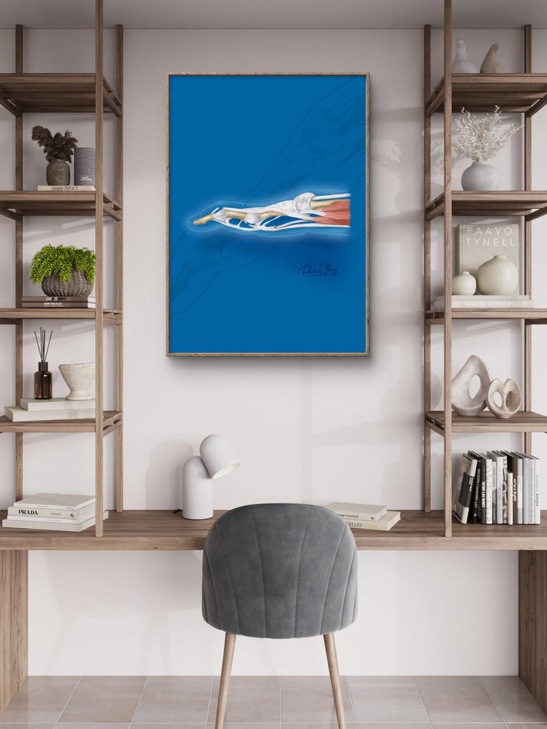 Swan Neck Finger Deformity Illustration Doctor's Office Decor Medical ...