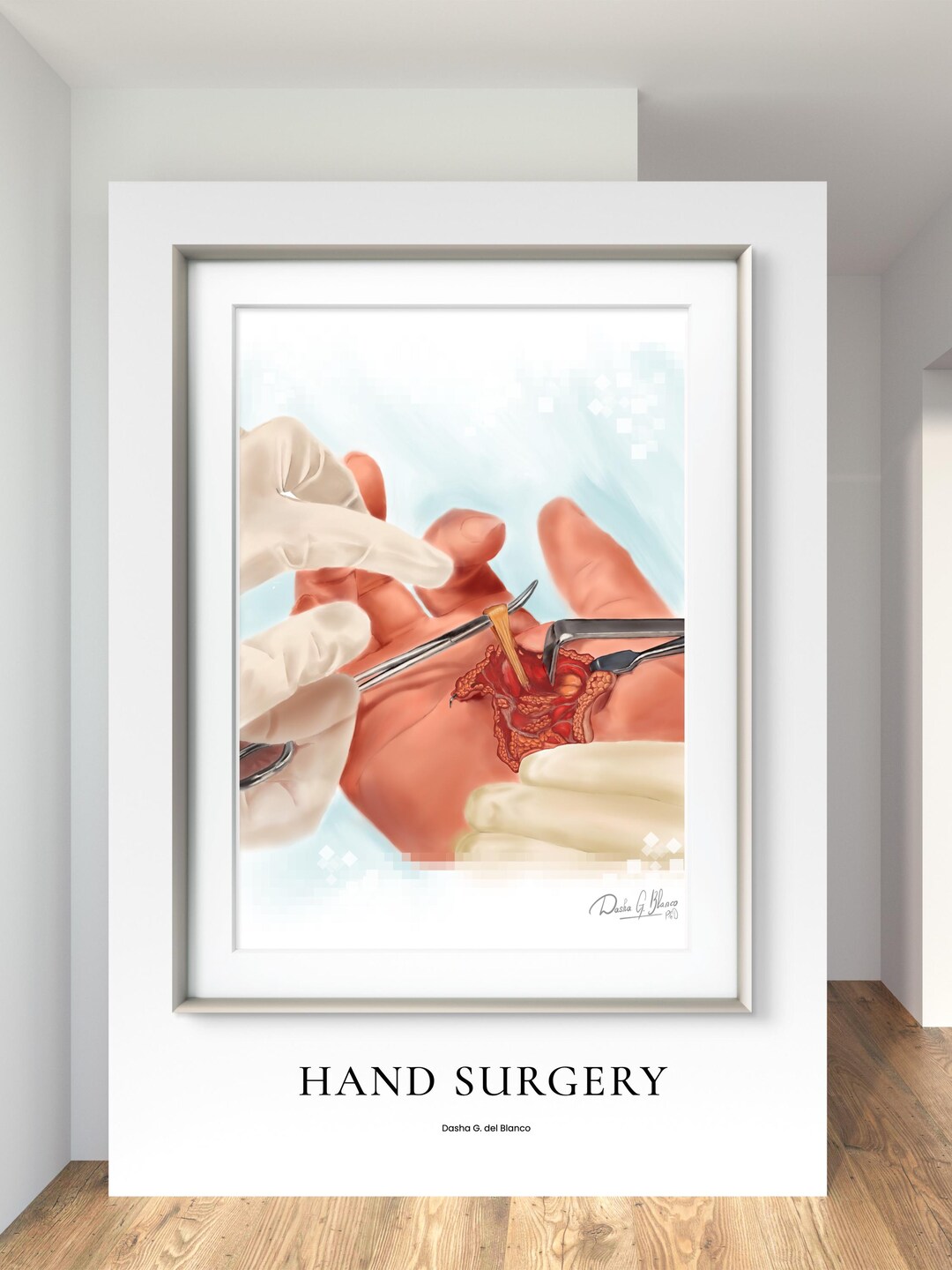 Medical Clinic Decor Plastic Surgery Art Hand Anatomy Print Hand ...