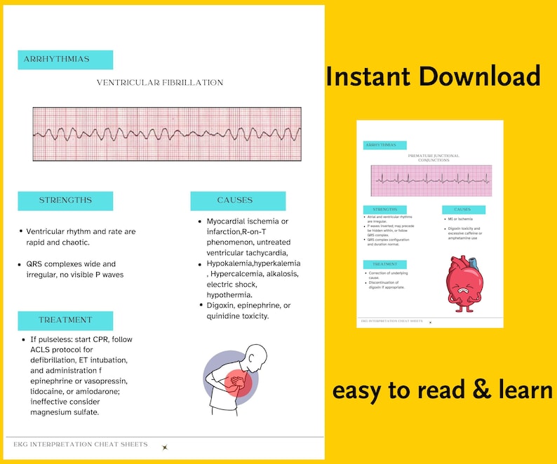 Rapid EKG Interpretation & Heart Arrhythmias Cheat Sheet ,cheat Sheets ...