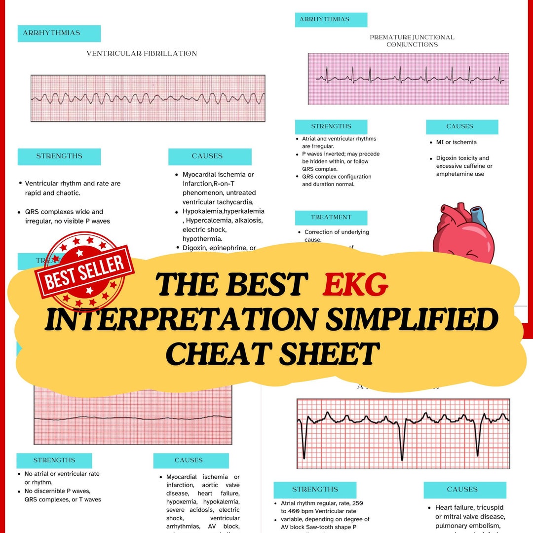 The Best EKG Interpretation & Heart Arrhythmias Cheat Sheet ...
