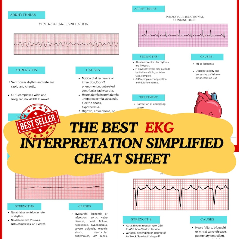 The Best EKG Interpretation & Heart Arrhythmias Cheat Sheet ,dysrhythmias Interpreting Ekg ,ekg ...