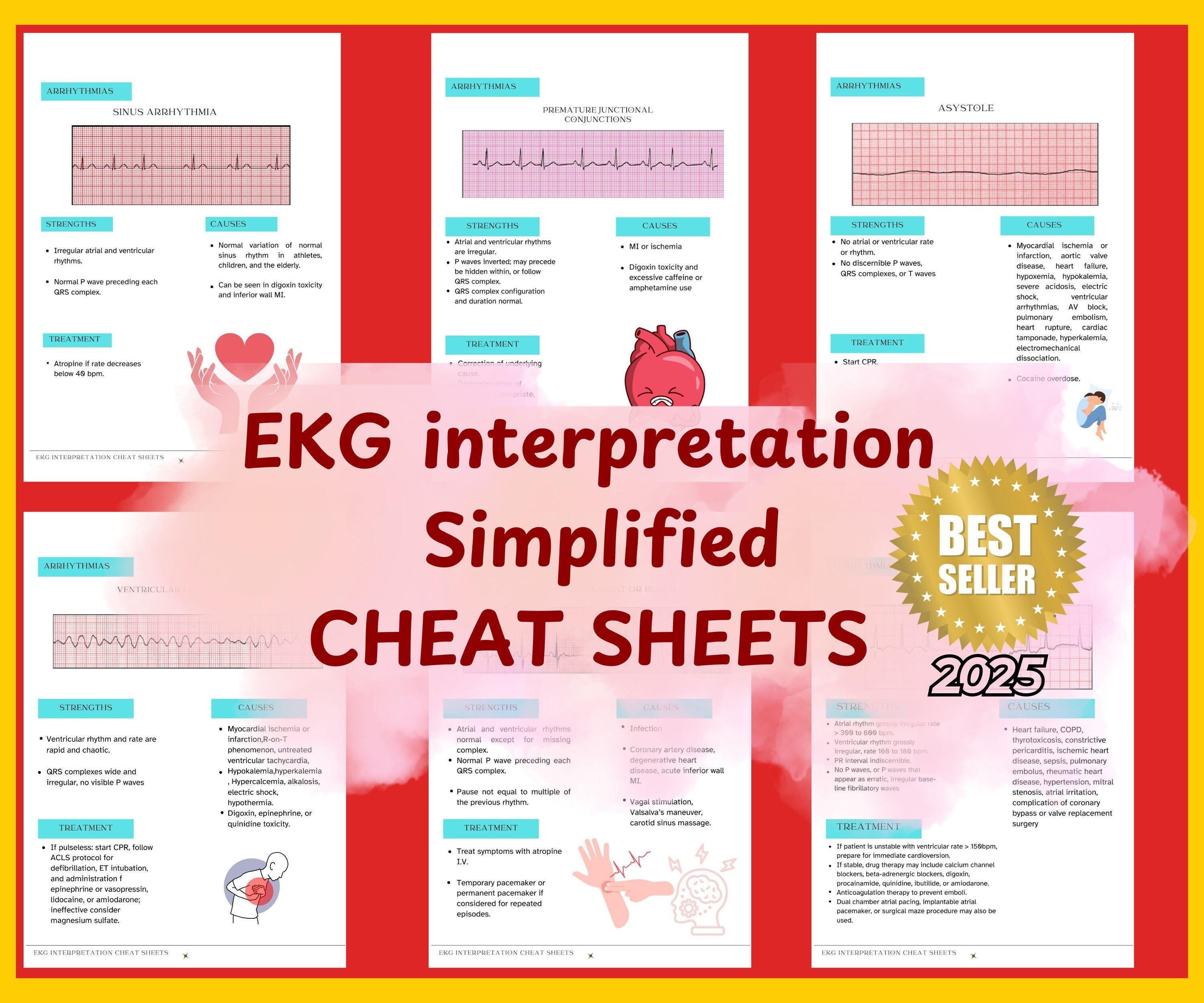 EKG Interpretation &heart Arrhythmias Study ,simplified Cheat Sheet ...