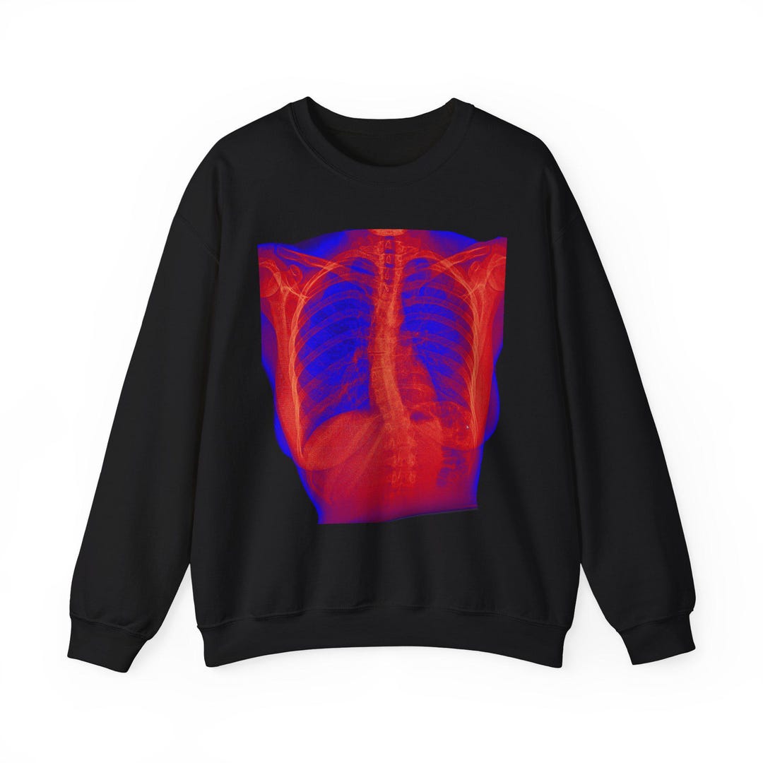 Thermal X-ray Scoliosis Sweatshirt: Spooky Medical Anatomy Pullover - Etsy
