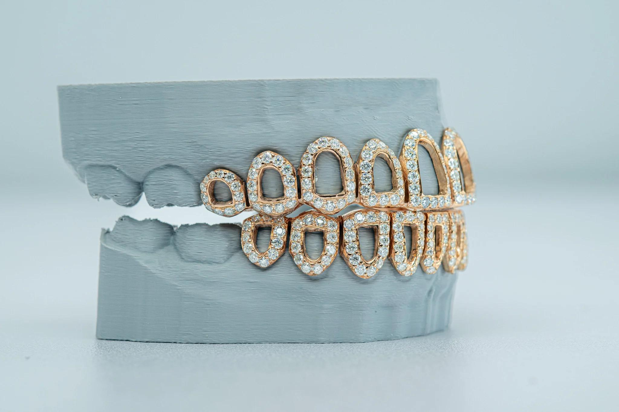 Open Face Diamond Grillz | Custom Bust Down VVS Moissanite Teeth ...