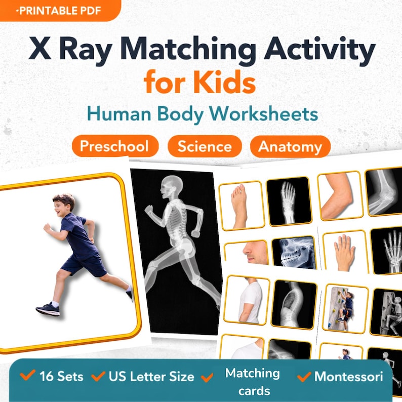 X Ray Matching Activity for Kids | Human Body Science Worksheets (PDF ...