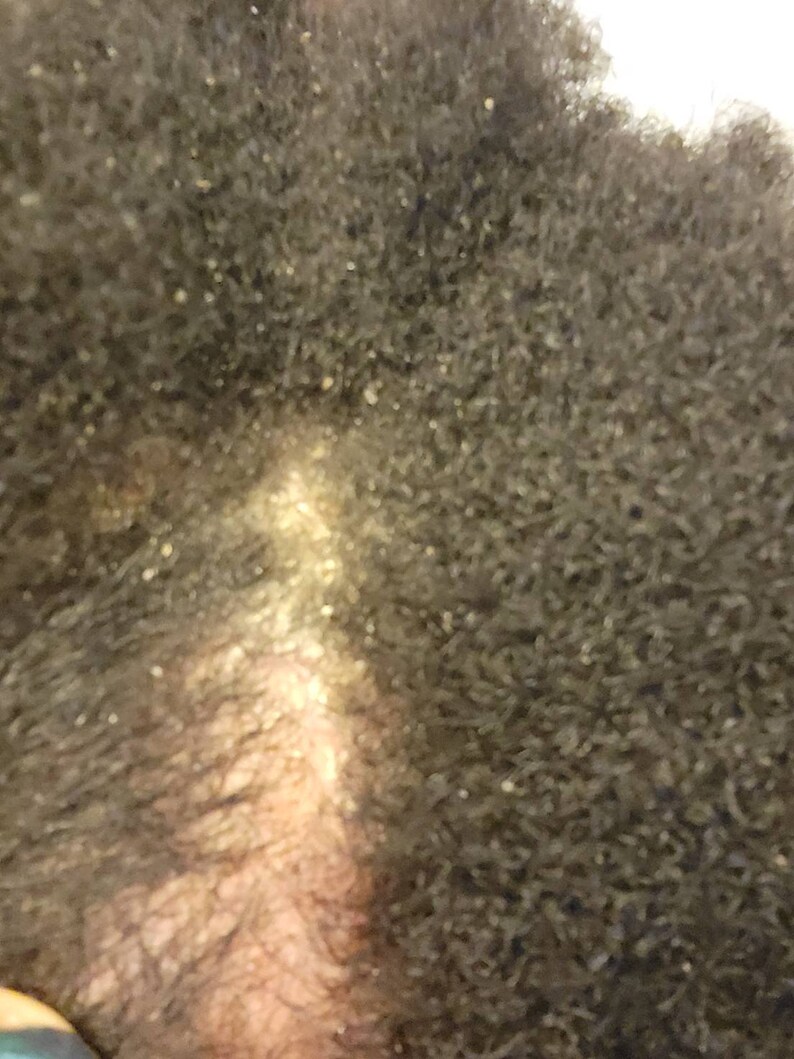 Hair Oil With Rosemary Castor Fenugreek Organic Oils for Dry Scalp ...