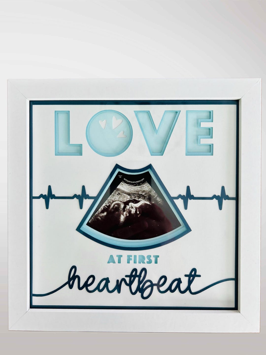 Love at First Heartbeat Ultrasound 3d Shadow Box Frame - Etsy