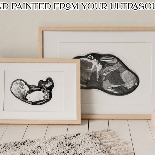 Infertility - Etsy