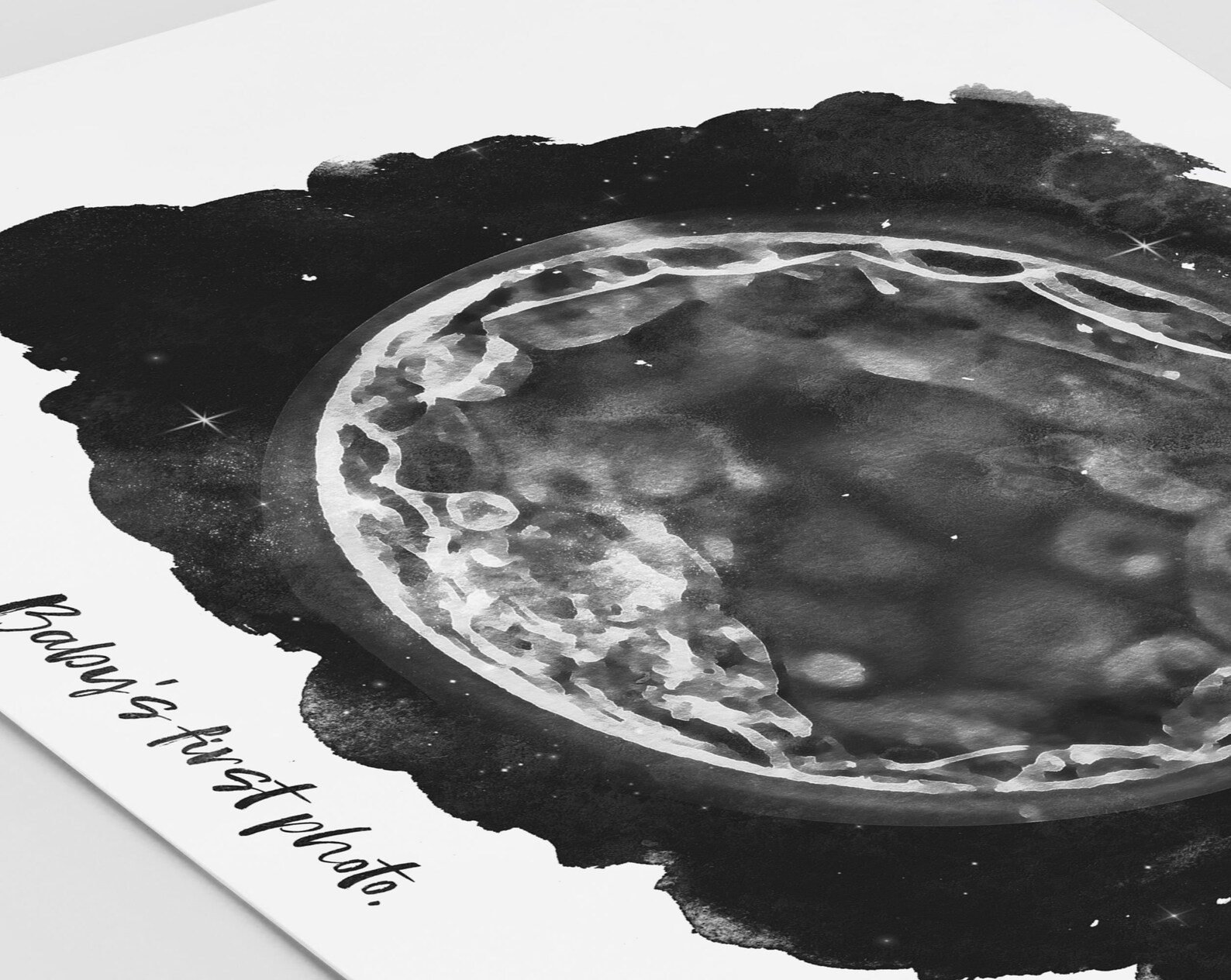 Watercolor IVF Embryo Art Print - Digital File Included - Custom New ...