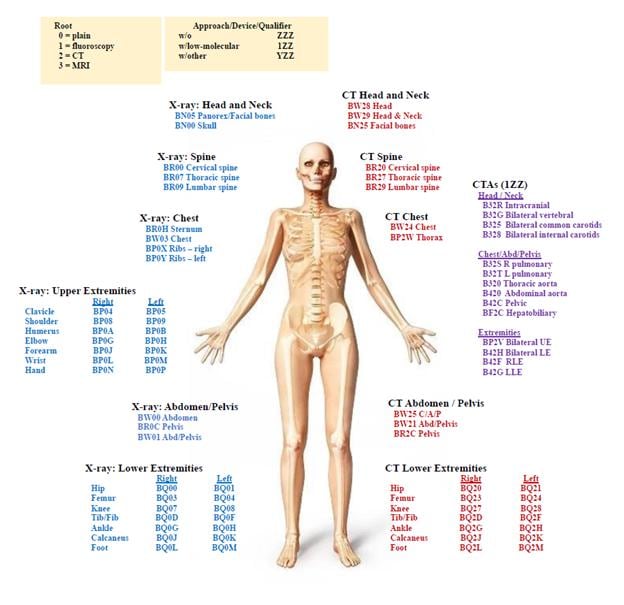 ICD 10 PCS Radiology Code Cheat Sheet - Etsy
