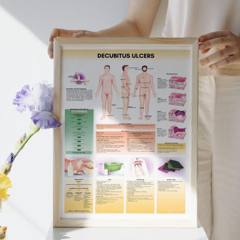 Decubitus Ulcers Anatomy Poster, Human Biology Art (digital Download ...