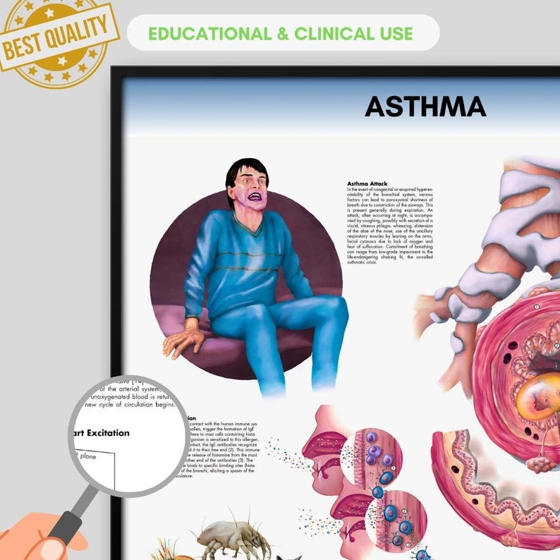 Asthma Anatomy Poster, Human Biology Medical Print (digital Download ...