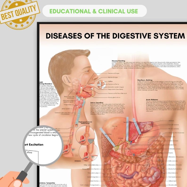 Digestive System Diseases Poster, Human Anatomy Print (digital Download ...