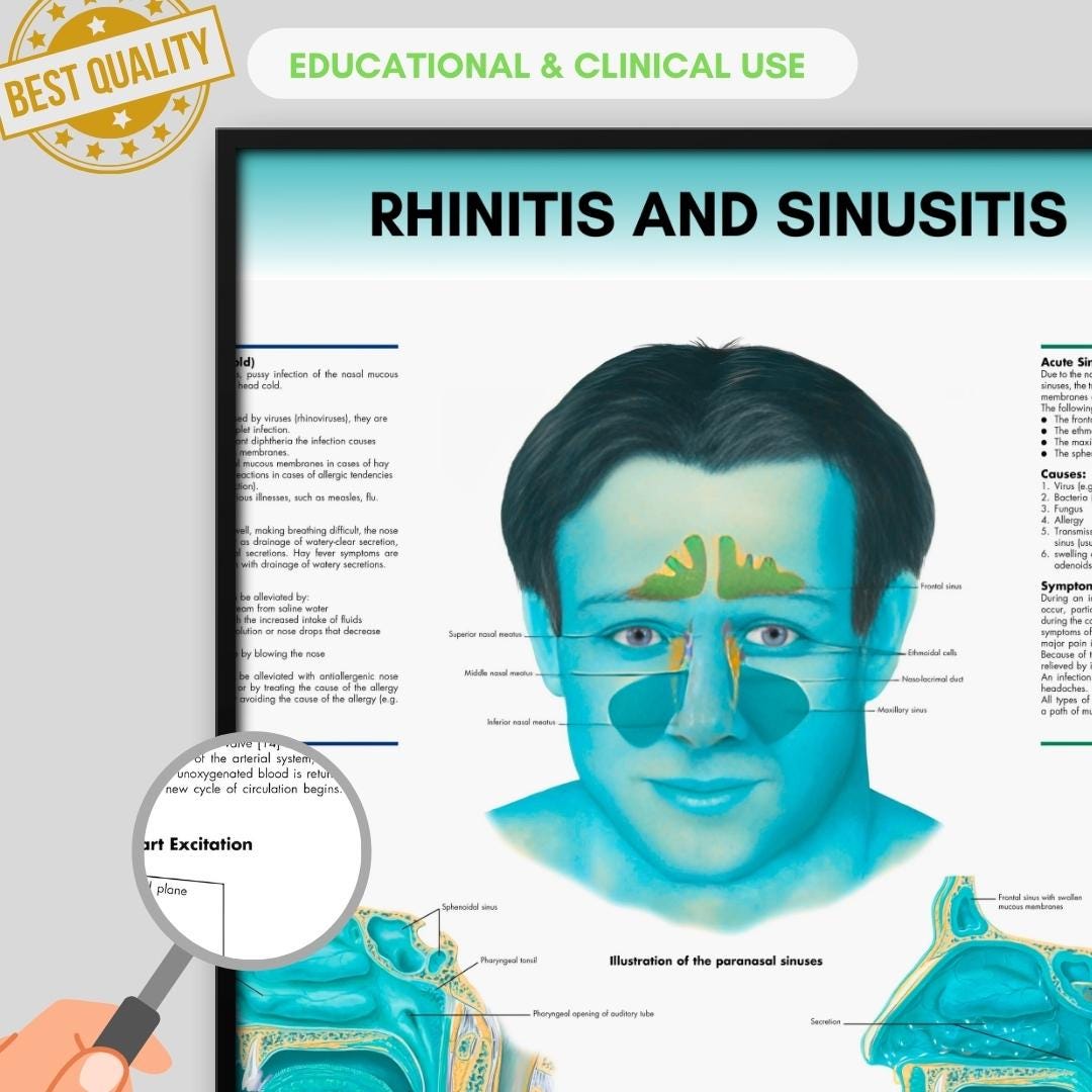 Rhinitis Sinusitis Anatomy Poster, Human Biology (digital Download) - Etsy