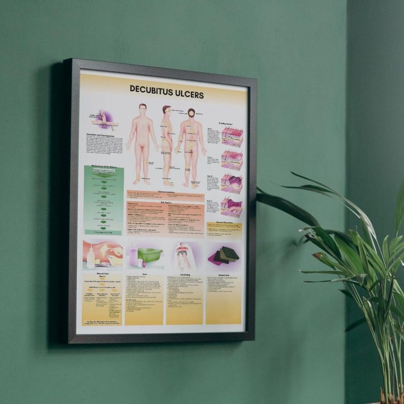 Decubitus Ulcers Anatomy Poster, Human Biology Art (digital Download ...