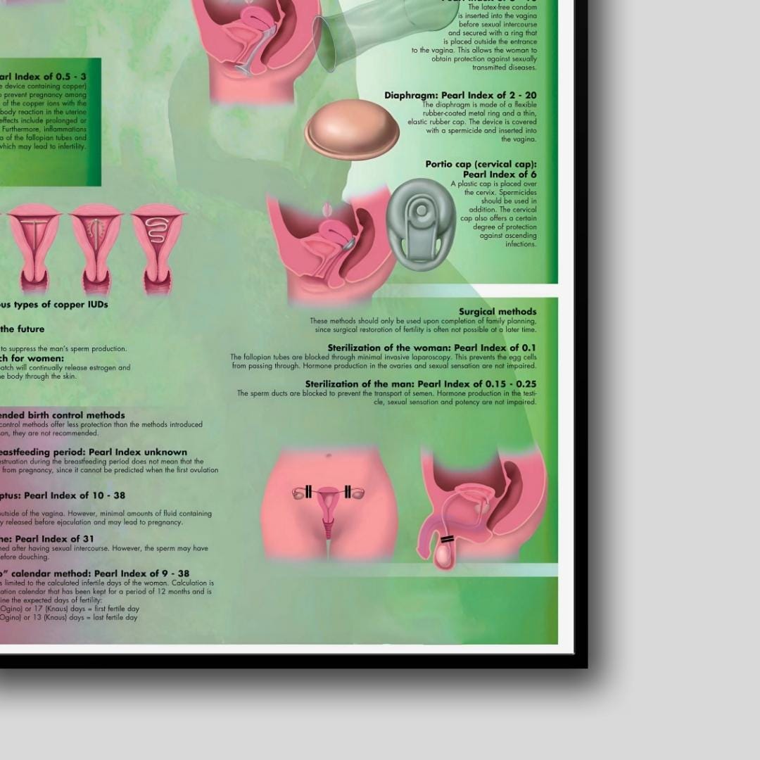 Birth Control Poster Anatomy Human Biology Poster Medical Student ...