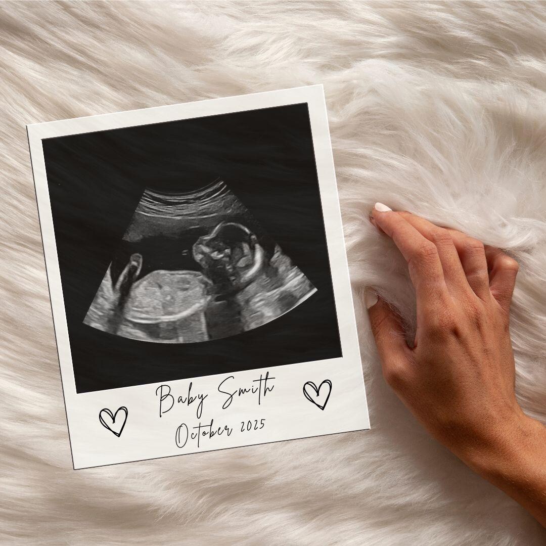 Pregnancy Announcement Editable Template, Polaroid Baby Announcement ...