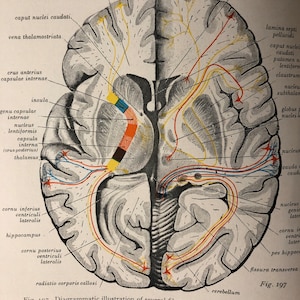 Central Nervous System Brain Cross Section - 1954 Human Anatomy ...