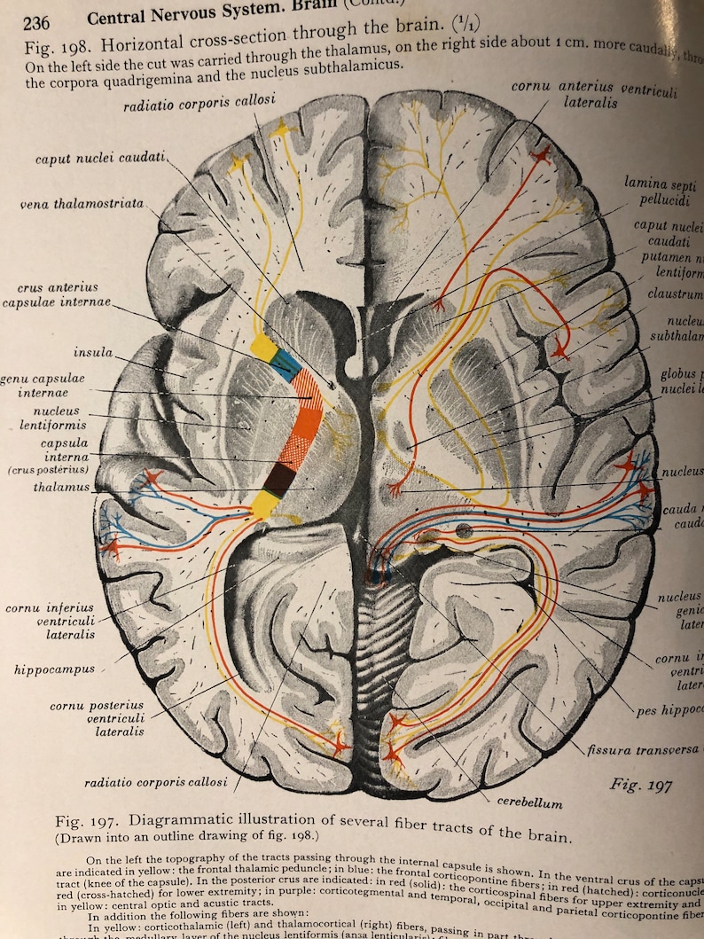 Central Nervous System Brain Cross Section - 1954 Human Anatomy ...