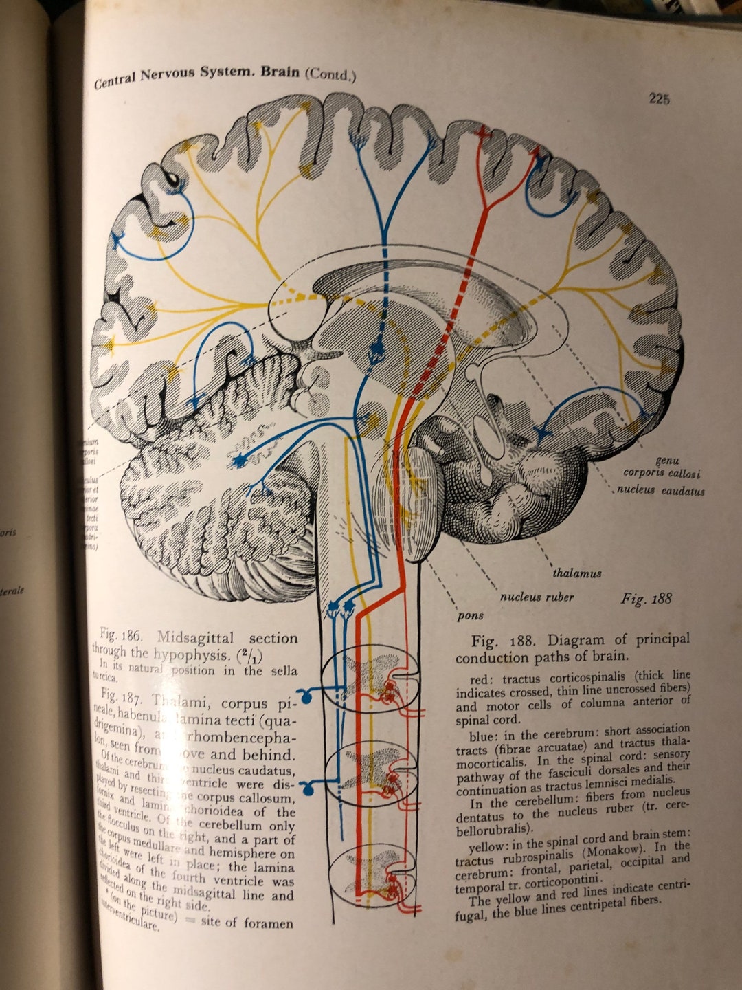 Central Nervous System Brain Cross Section - 1954 Human Anatomy ...