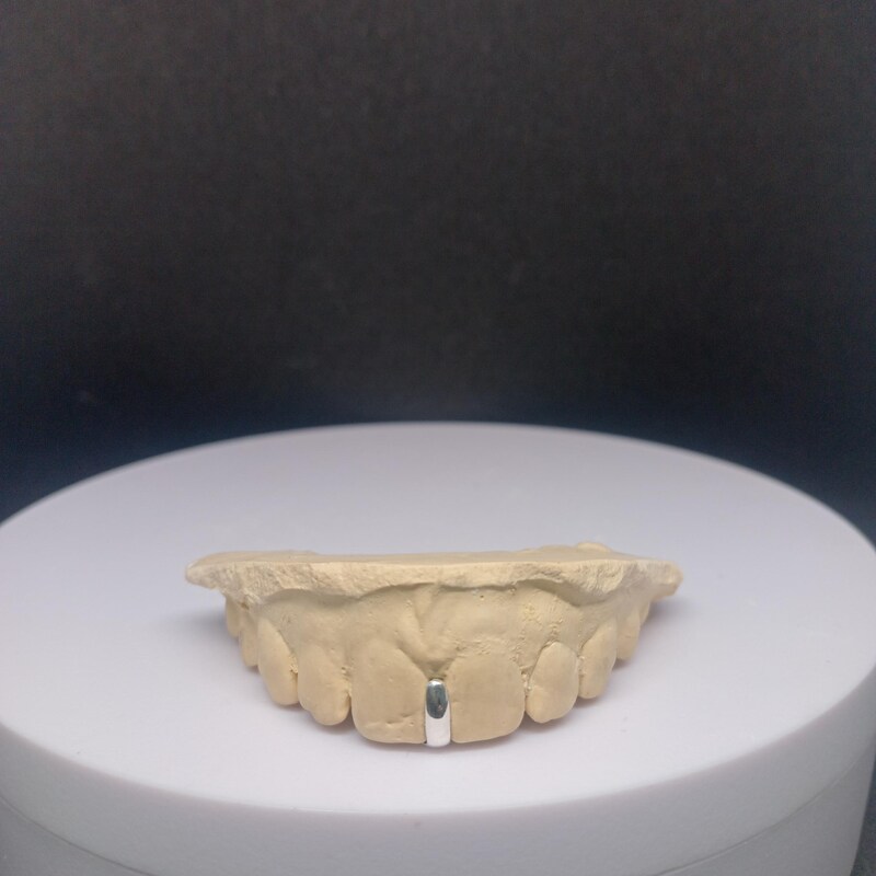 Gap Filler Grillz - Etsy UK