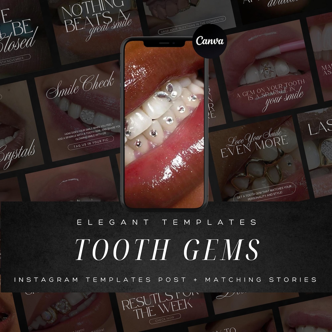Tooth Gem Instagram Templates – Dentist & Cosmetic Dental Canva Social ...