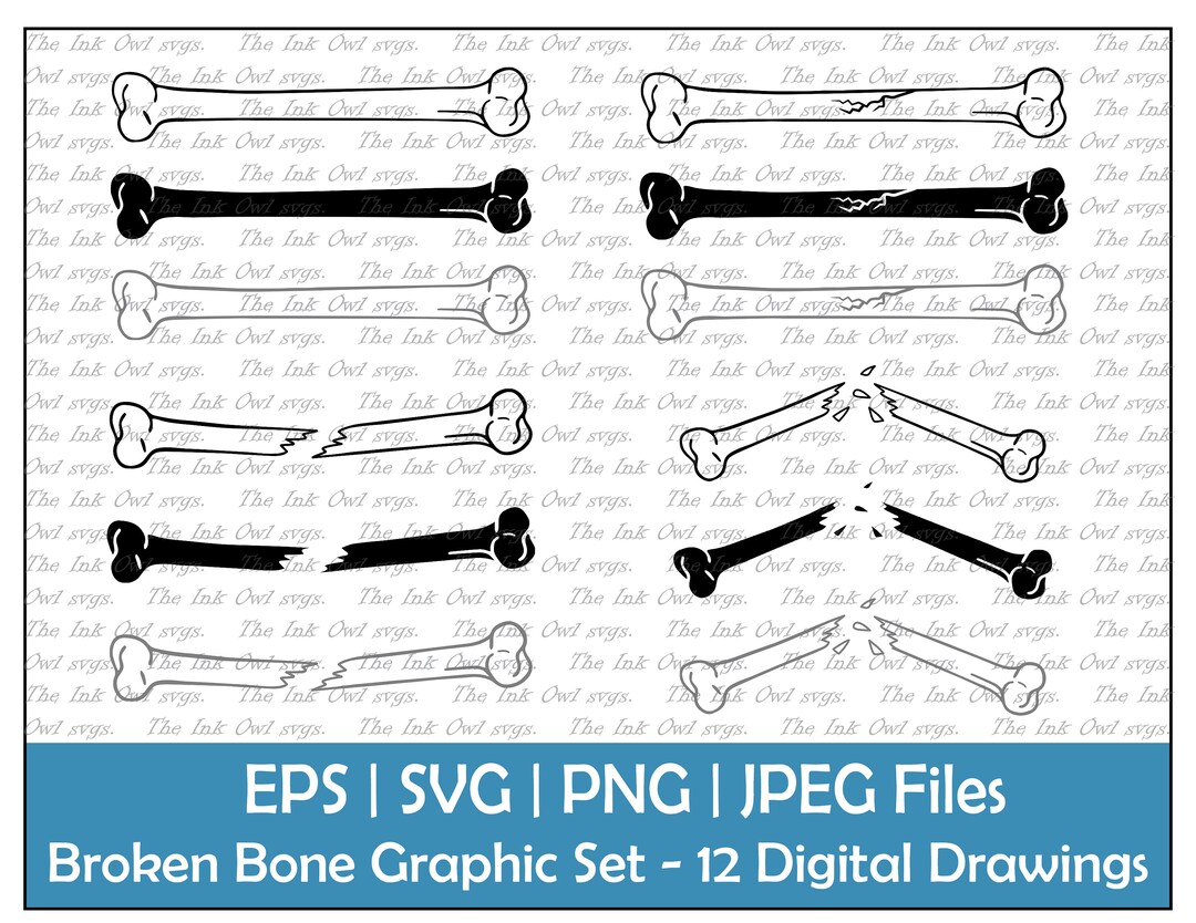 Broken Fractured Bone Vector Clipart Set / Outline & Stamp Drawing ...