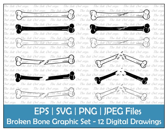 Broken Fractured Bone Vector Clipart Set / Outline & Stamp | Etsy