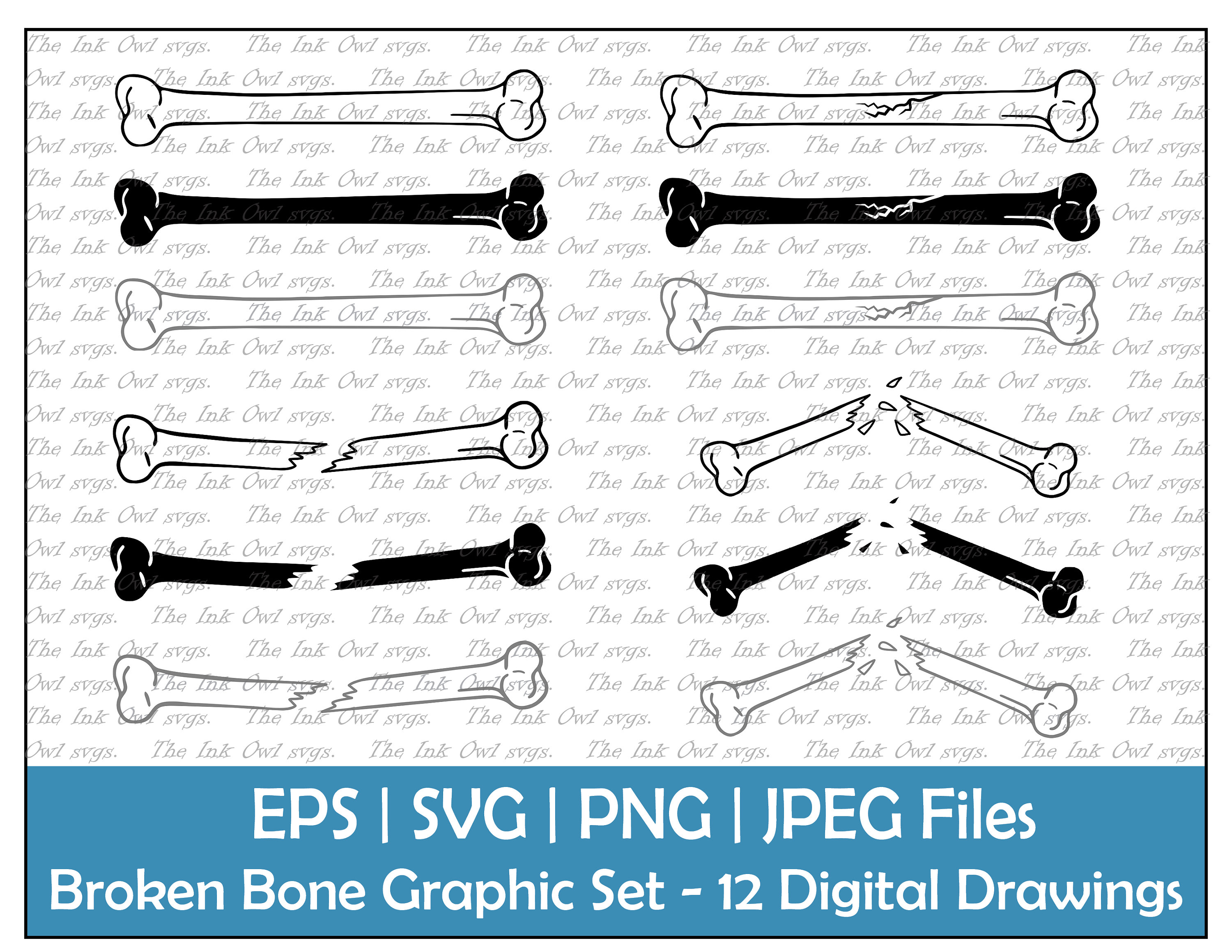 Broken Fractured Bone Vector Clipart Set / Outline & Stamp | Etsy