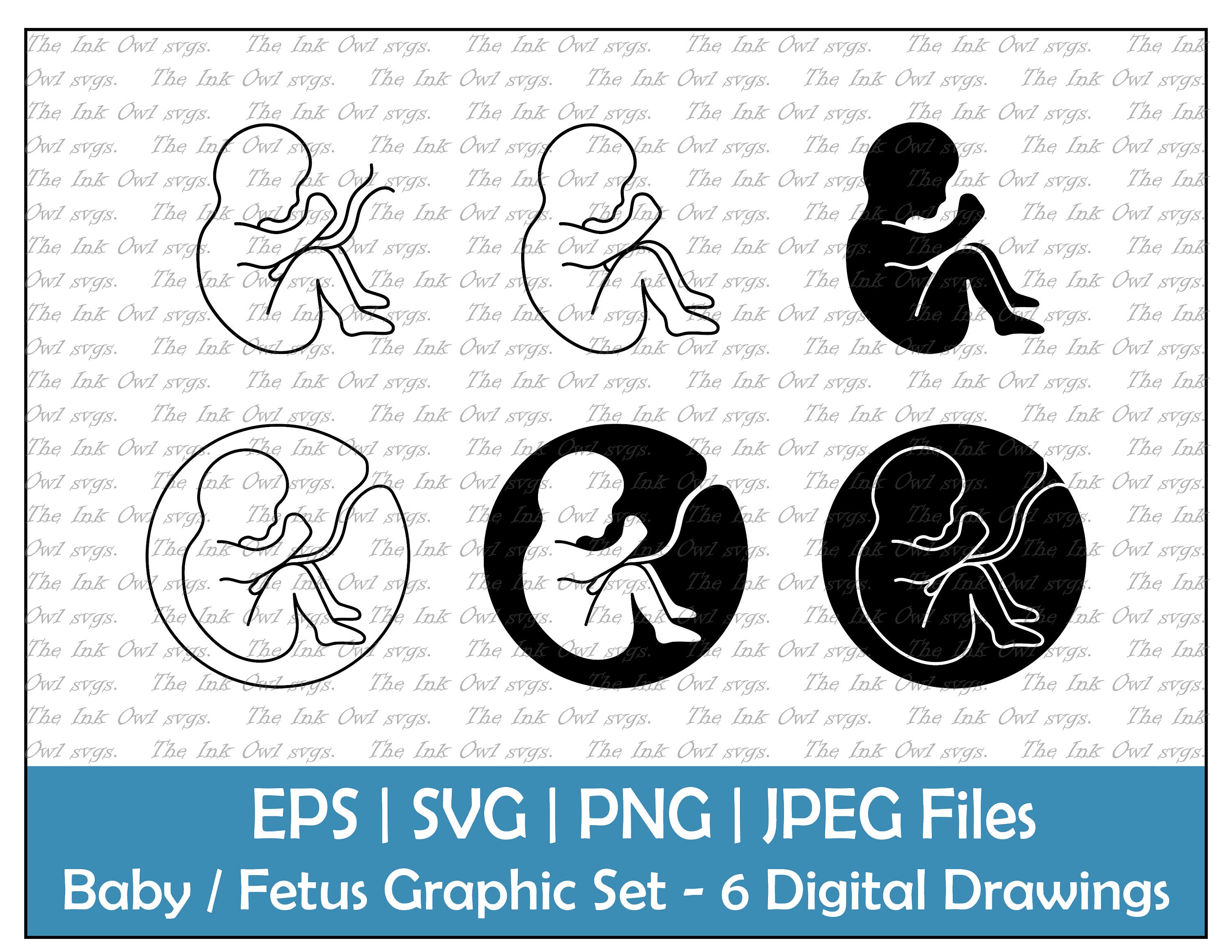 Umbilical Cord Clipart Of Flowers