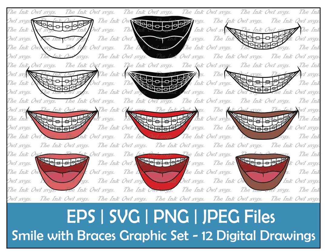 Smile With Teeth and Braces Vector Clipart / Outline, Silhouette Stamp ...