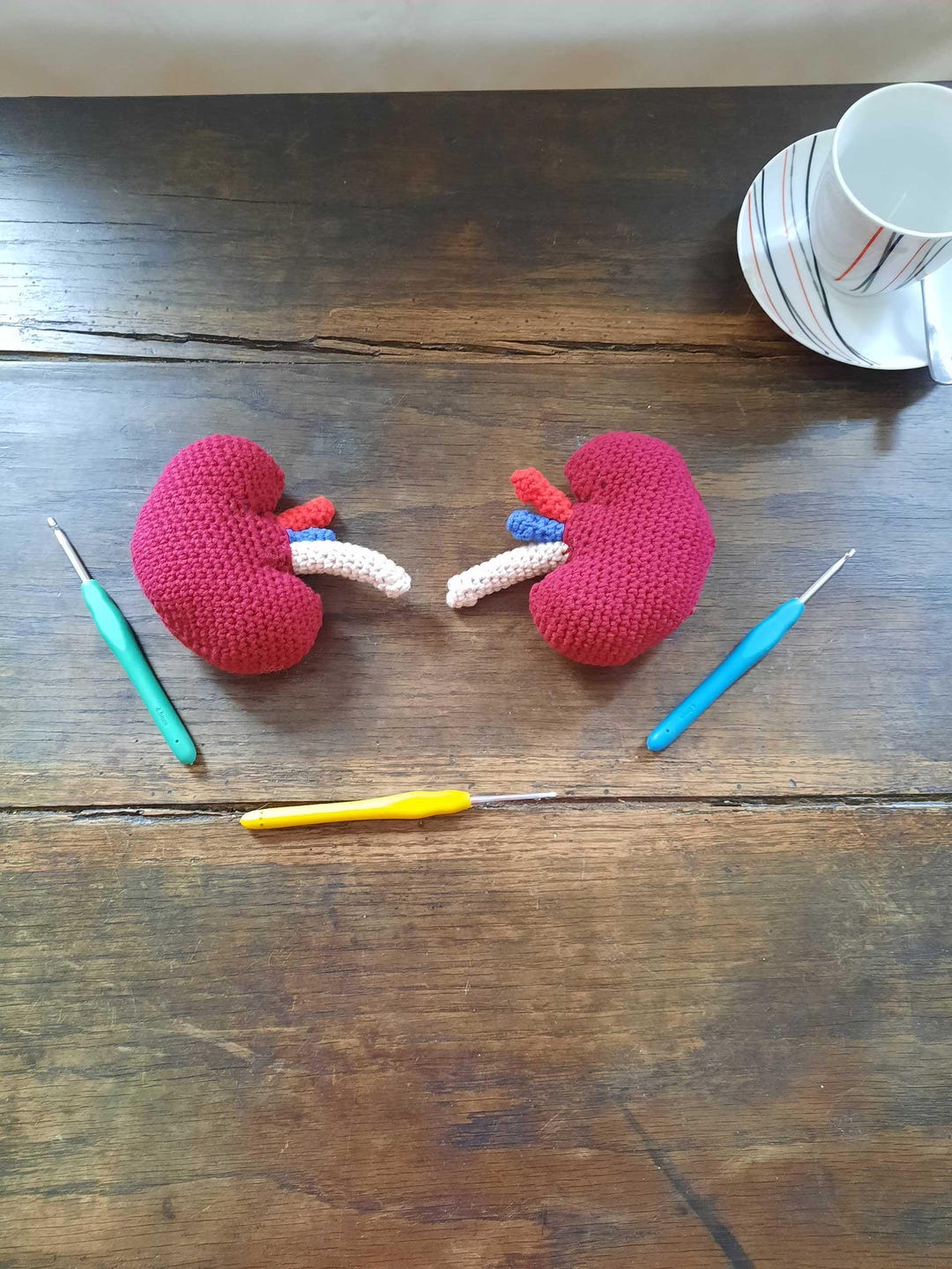 Crochet Kidneys Educational and Original Decoration - Etsy