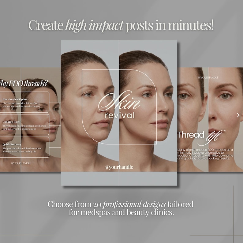 PDO Thread Lift Before & After Instagram Posts: Medspa Social Media ...