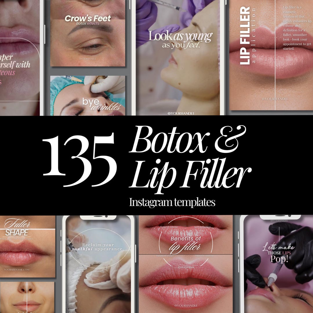 Botox & Lip Filler Posts and Reels: Nurse Injector Instagram Templates ...